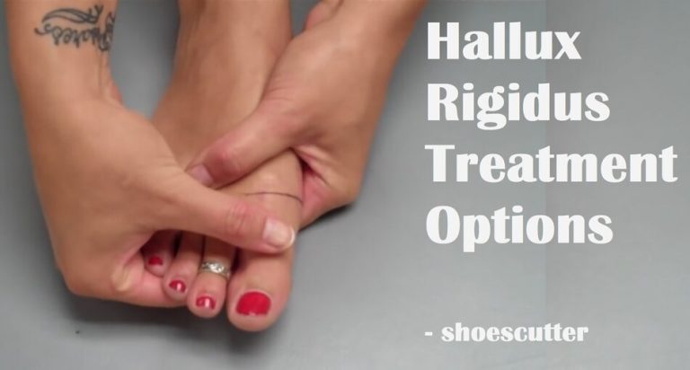 Hallux Rigidus Treatment Options | Non-Surgical & Surgical Treatment